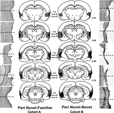 Diagrammatic Reconstructions Of The Perirhinal Cortex Lesions Peri