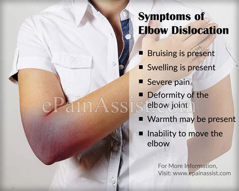 Elbow Dislocation Or Dislocated Elbow Symptoms Causes Treatment
