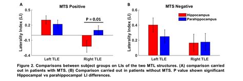 Lateralization Of Visual Spatial Memory In Temporal Lobe Epilepsy