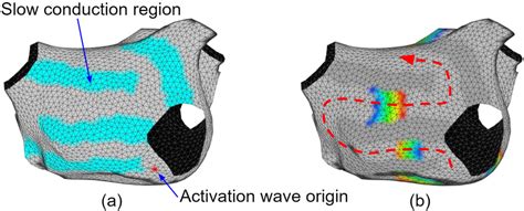 Zigzag Propagation A Simulation Setup Slow Conduction Regions Are