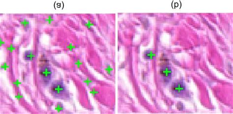 Nuclei Detection Results By The Technique In 21 A Results Before Download Scientific