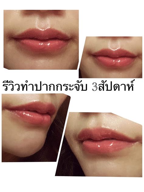 👄 ลำดับความสวย Belle Clinic เบลล์คลีนิกเวชกรรม เพจหลัก