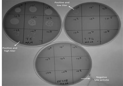 Spot Test View Of The Lytic Activity Of Sp2021 On Clinical Strains Download Scientific Diagram