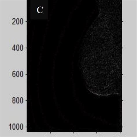 First Level Db4 Wavelet Decomposition A Original Mammography Image Download Scientific