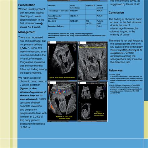 A 2 D Imaging Of Chorionic Bump Download Scientific Diagram