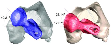 Details Of The Analysis Of The Rotational Distortion On The Virtual