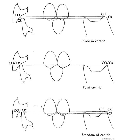 Occlusion Pptx Dr Munia Muhadharaty