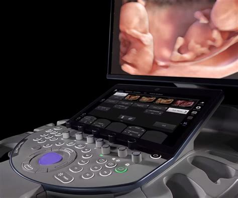 The Arrival Of The Ge Voluson Expert 22 Ultrasound Machine