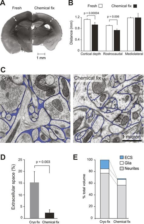 Figures And Data In Ultrastructural Analysis Of Adult Mouse Neocortex Comparing Aldehyde