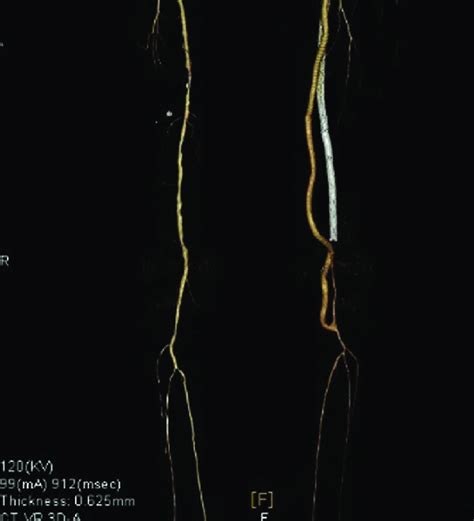 Three Dimensional Computed Tomography Reconstruction From Images Download Scientific Diagram