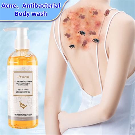 Anti Acne Body Wash Antibacterial Shower Gel Mites Acne Remover