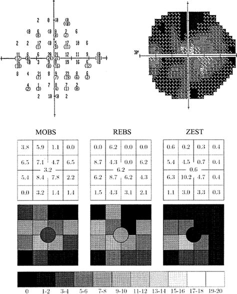 An Example Of The Fdt Perimetry Data Collected From The Left Eye Of A