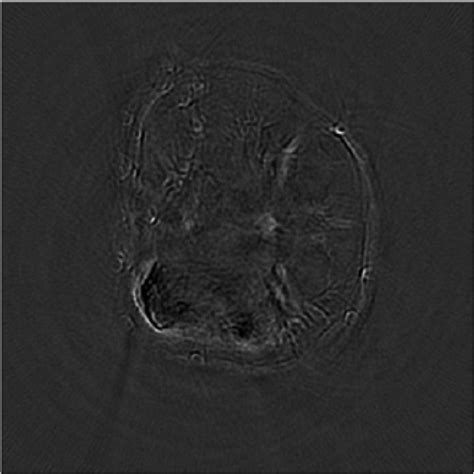 Github Baturayozguruncomputervisionprojectsegmentationalgorithmwithopencv