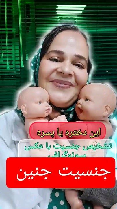 📣تشخیص جنسیت جنین از روی عکس سونو👍دختر بود یا پسر؟نینی سالم باشه ️ساب