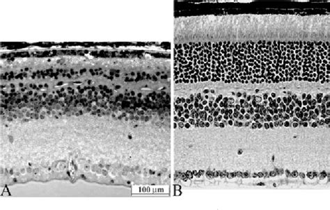 Figure 1 From Aav Mediated Gene Therapy For Retinal Degeneration In The