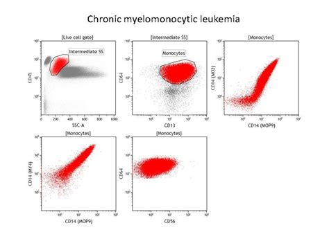 Our Flow Cytometer Device