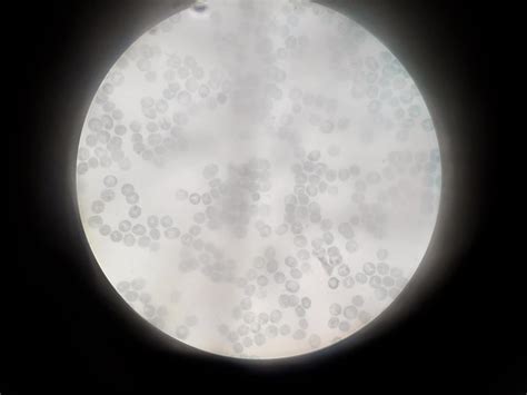 Cuaderno De Prácticas Hematologia Contaje De Reticulocitos Práctica