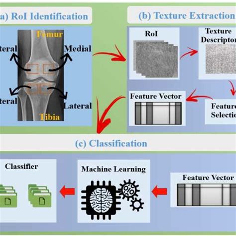 Normal And Osteoarthritis Oa Knee X Ray Imagery Download Scientific Diagram