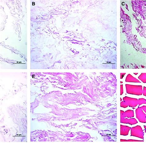 Protein Content Of Skeletal Muscle And Decellularized Ecm Protein Download Scientific Diagram
