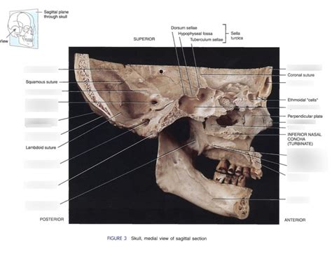 Medial View Of Sagittal Section Diagram Quizlet