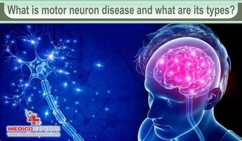 Motor Neuron Disease Treatment In India Current Options