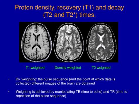 Ppt Introduction To Fmri Physics For Dummies Like Me Powerpoint