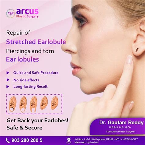 Earlobe Repair Surgery In 2025 Surgery Plastic Surgery Repair