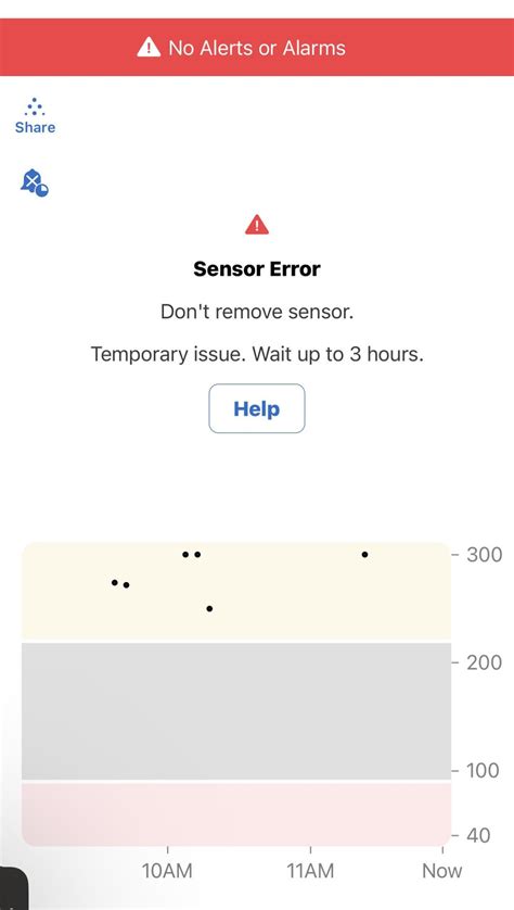 Bro… I Hate Dexcom Most Days R Dexcom