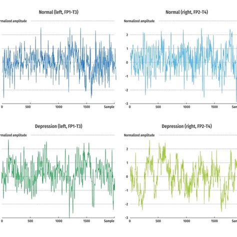 Pdf Automated Eeg Based Screening Of Depression Using Deep Convolutional Neural Network