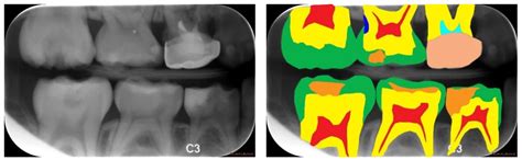 Borea17 U Net Convolutional Networks For Biomedical Image Segmentation