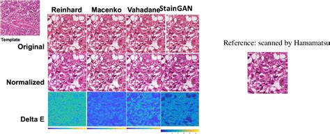 Figure 2 From Characterization Of Color Normalization Methods In