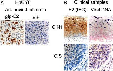 Figure 1 From Tumor Suppressor Or Oncogene A Critical Role Of The Human Papillomavirus Hpv E2