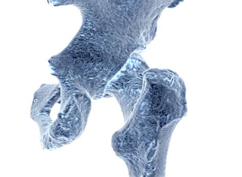 Hip 3d Bone Reconstruction From Mri Photograph By Science Photo