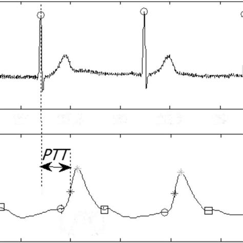 Figure2 Example Of Ecg And Ppg Signal Ptt And Pw Representation Download Scientific Diagram