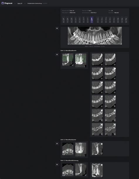 Artificial Intelligence And Deep Learning In Dental Radiology
