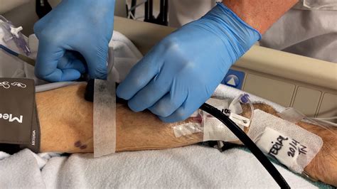 Non Invasive Monitoring Of Microvascular Oxygenation And Reactive