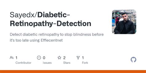 Github Sayedxdiabetic Retinopathy Detection Detect Diabetic
