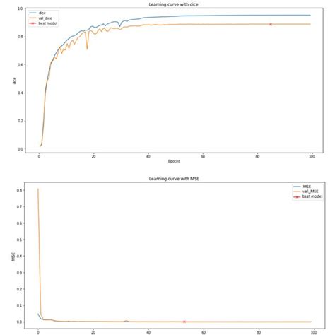 The History Graph Of Our Proposed Model Based On Dc And Mse Metrics To Download Scientific