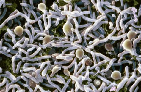 Cold Loving Extremophile Bacteria Sem Stock Image B2440067