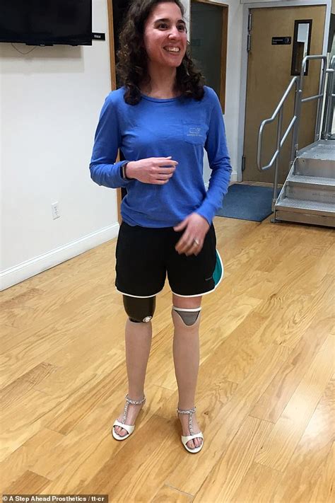 Pin By Jacor653 On Prosthetics And Amputees Amputee Model Woman
