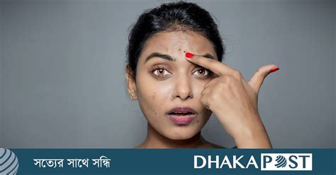 মুখের দাগ দূর করবে এই ৩ ফেসপ্যাক