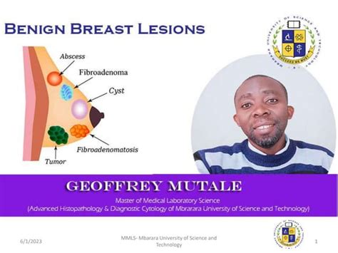 Benign Breast Lesions Pptx