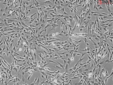 SC Human Hepatic Stellate Cells Biotrend