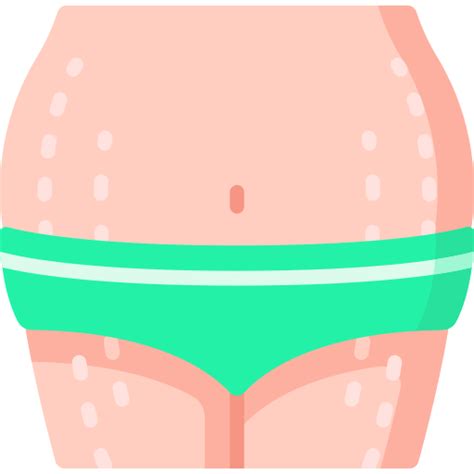Stretch Marks Special Flat Icon