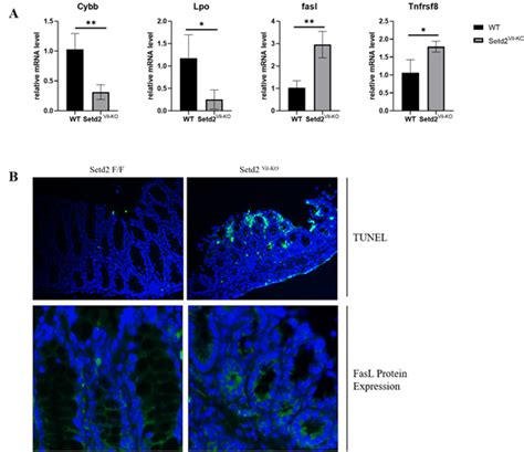 Setd2 Deficiency Promotes Inflammatory Bowel Disease Via Oxidative