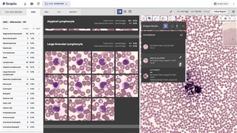 Scopio Full Field Digital Cell Morphology Siemens Healthineers