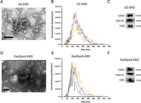 Exosome Isolation Kit Comparison At Isaac Oppen Blog