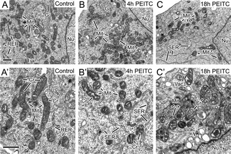 Alteration Of Mitochondria Structure By Peitc Alteration Of Cellular