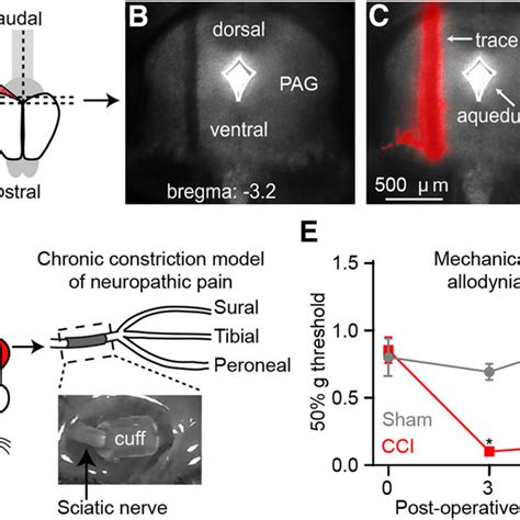 Excitation Profiles Of L2 3 And L5 Neurons In Mpfc Of Sham And Cci Download Scientific Diagram