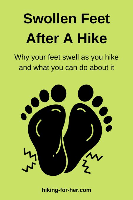 Swollen Feet After Hiking Best Tips For This Common Problem
